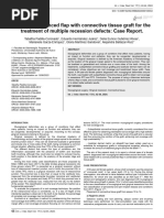 Classification of Dental Surface Defects in Areas of Gingival Recession ...