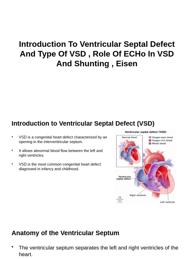 Types and Management of VSD | PDF | Internal Medicine | Cardiology