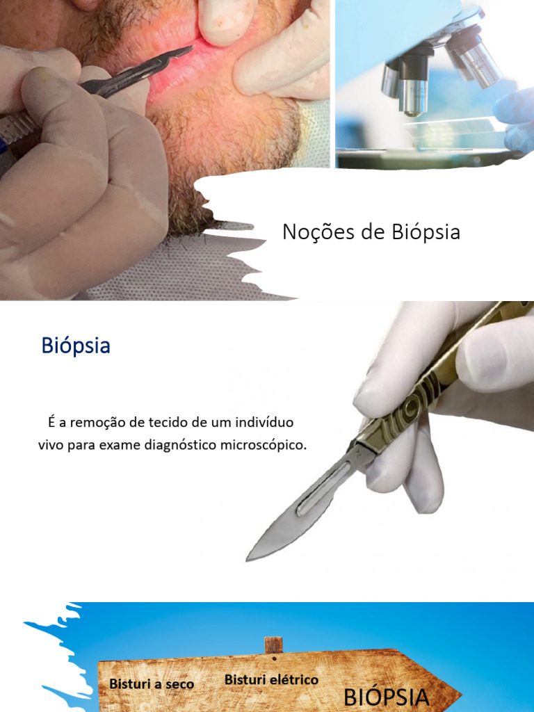 Guia Completo sobre Biópsia Clínica | PDF | Necrose | Remédio