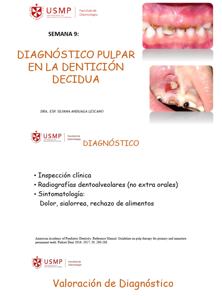 Semana 9 - 10 Diagnóstico Pulpar en La Dentición Decidua | PDF | Ramas ...