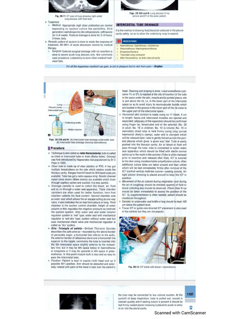 Surgery ICT Drainage | PDF