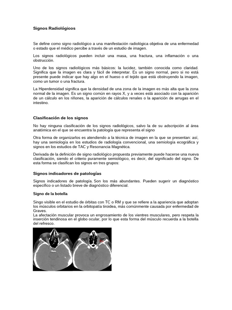 Signos Radiologicos Espinoza Yanes | PDF | Radiología | Ct Scan
