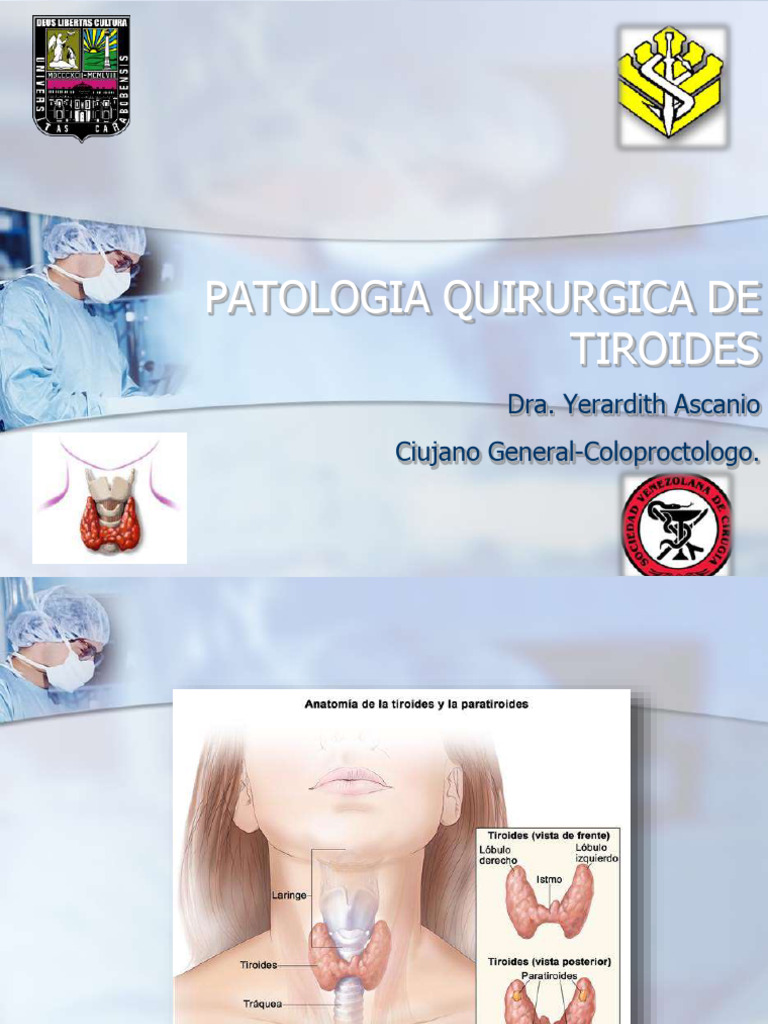 Patología Quirúrgica de Tiroides | PDF | Tiroides | Cáncer