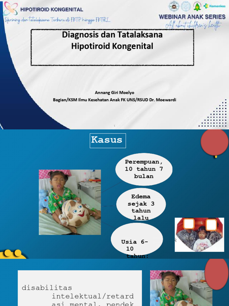 Hipotiroid Kongenital Diagnosis Tatalaksana Fix | PDF