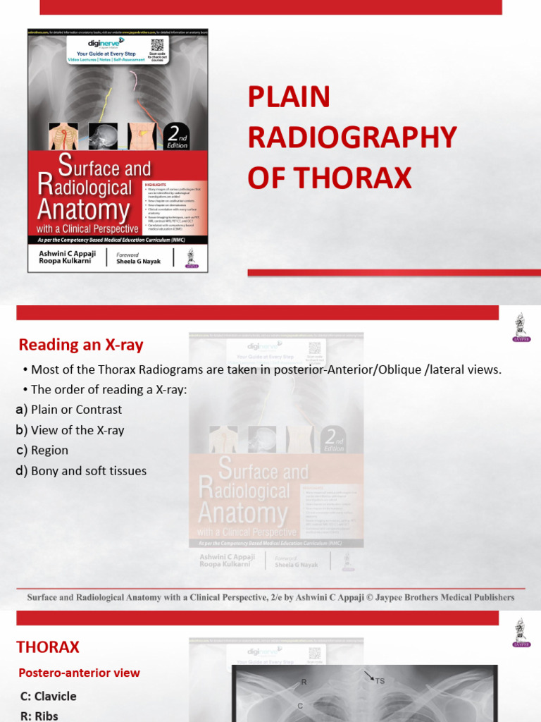 Thorax X-Ray Reading Guide | PDF