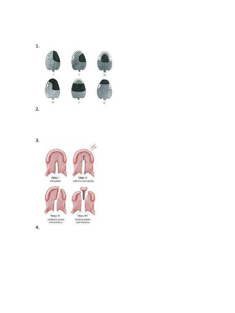 Prometric Exam Review: Dental Classifications and Techniques | PDF ...