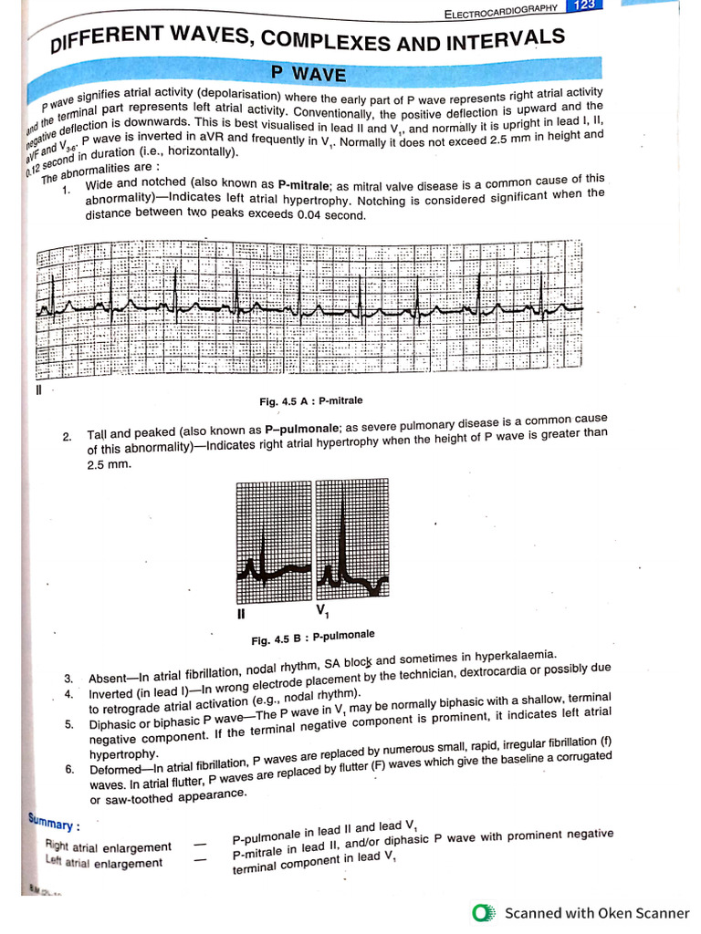 ECG Waves | PDF