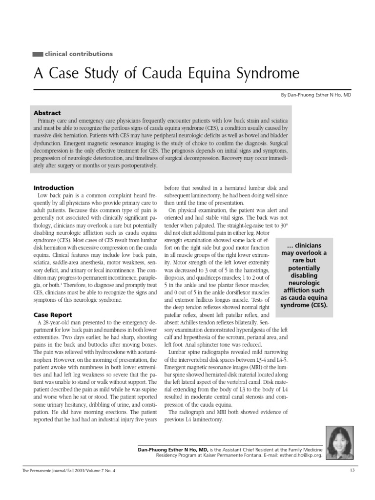 A Case Study of Cauda Equina Syndrome | PDF | Back Pain | Human Leg
