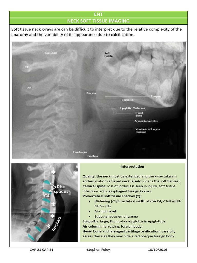 Soft Tissue Neck X-Ray Interpretation | PDF