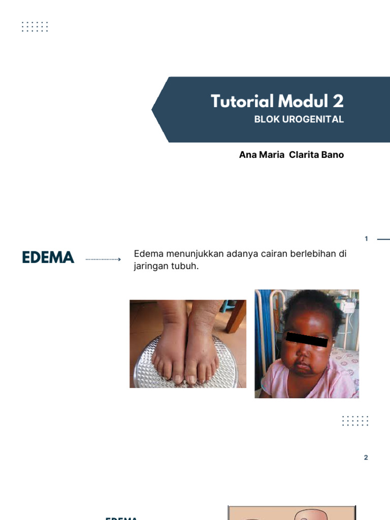 Penyebab dan Jenis Edema Urogenital | PDF