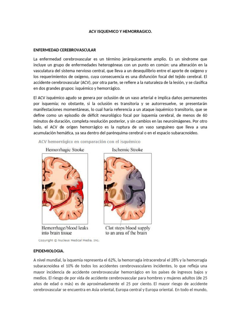 ACV Isquémico y Hemorrágico: Clasificación | PDF | Carrera | Isquemia