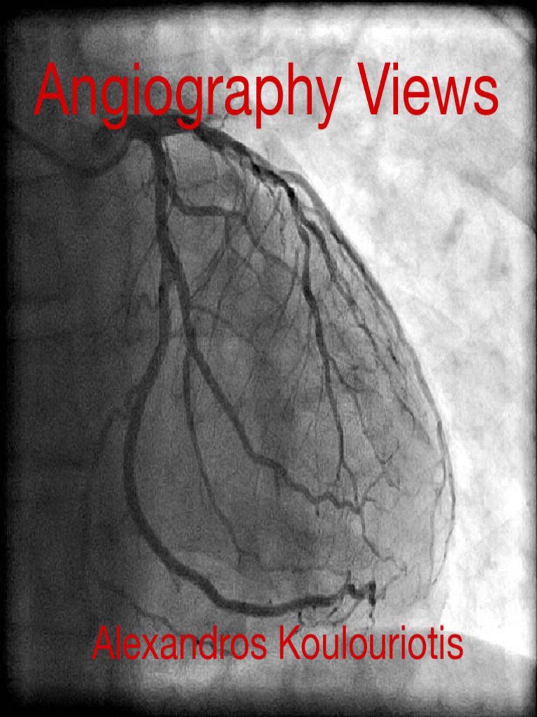 Coronary Angiography | PDF