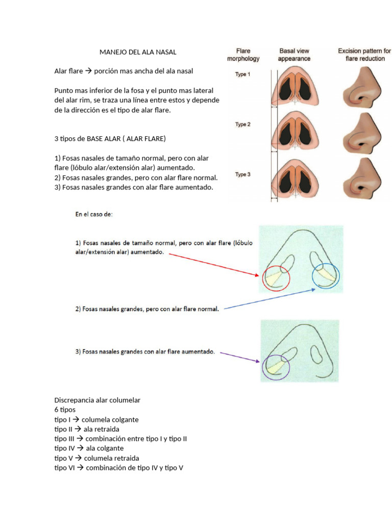 Tipos de Alar Flare y Discrepancias Nasales | PDF