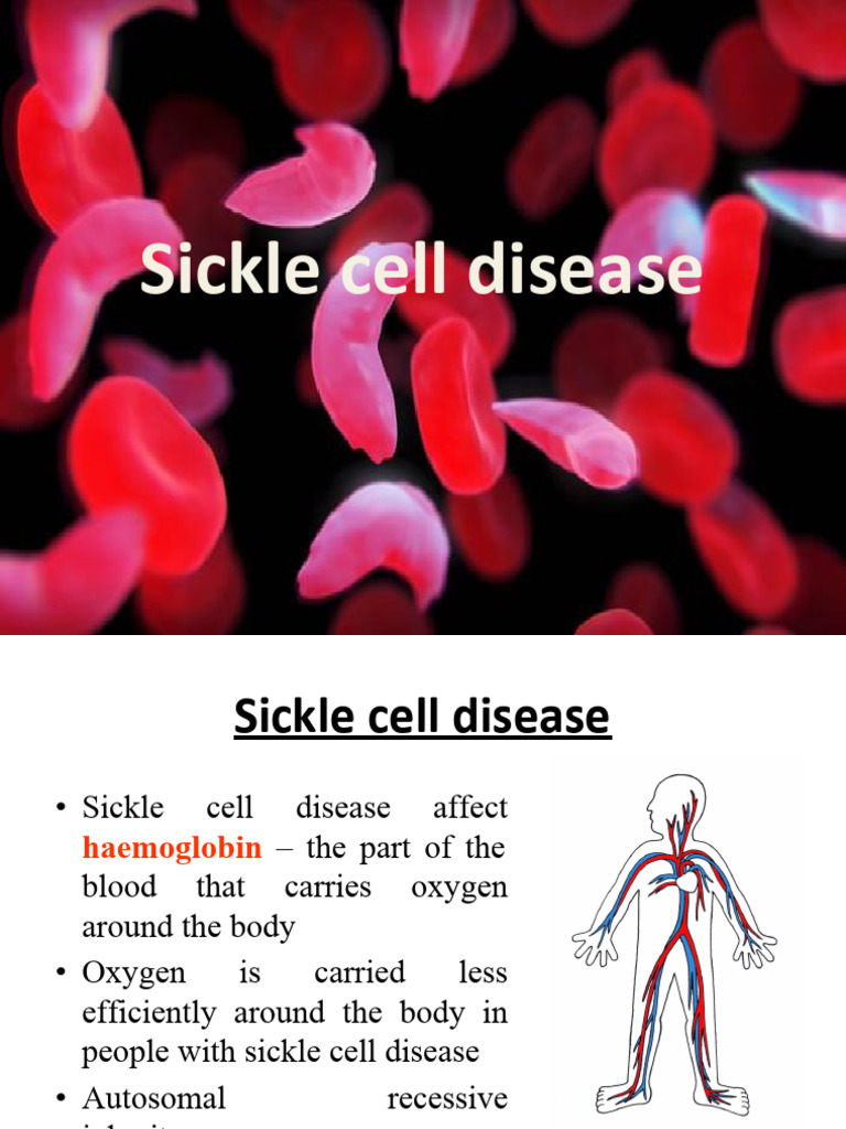 Sickle Cell | PDF | Genotype | Blood