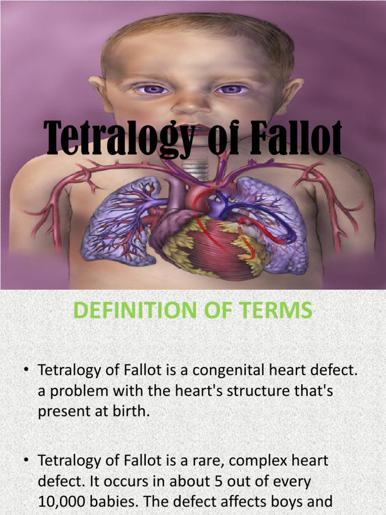 Understanding Tetralogy of Fallot | PDF | Heart | Ventricle (Heart)