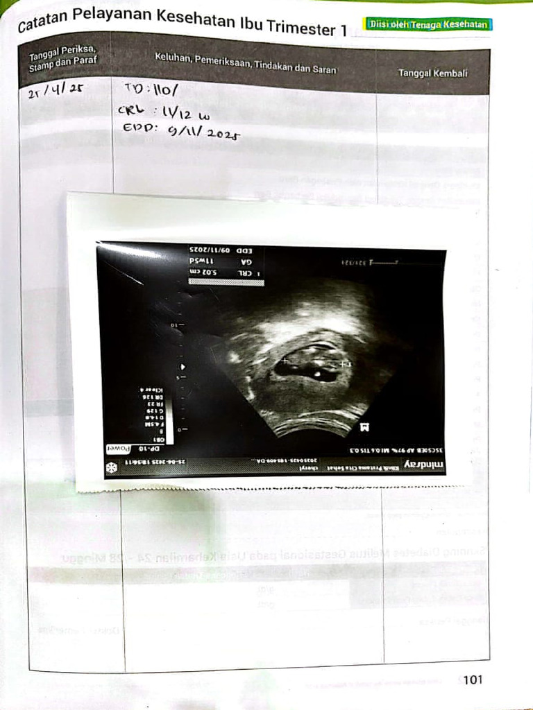 Hasil Usg | PDF