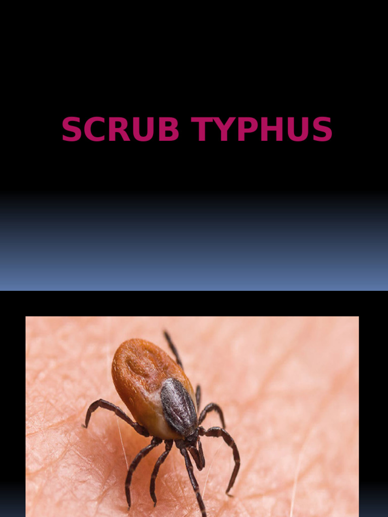 Overview of Scrub Typhus Disease | PDF | Immunology | Health Sciences