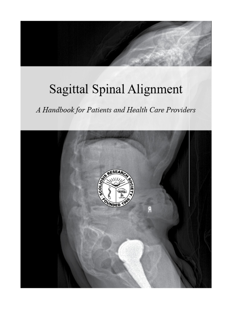 Understanding Sagittal Spinal Alignment | PDF | Vertebra | Scoliosis
