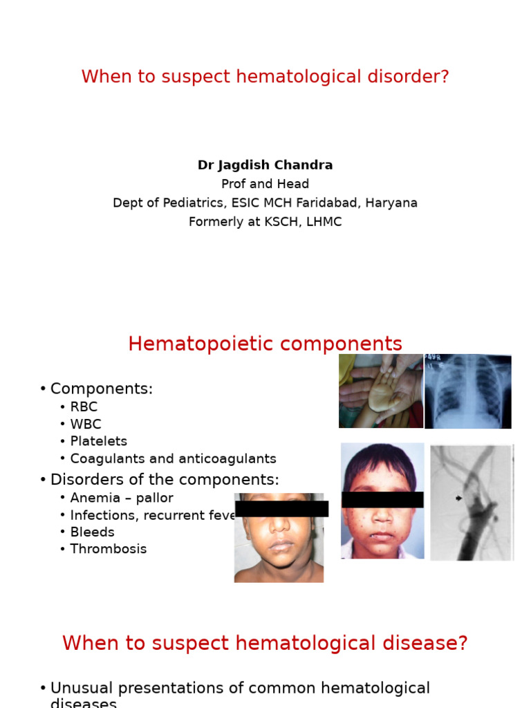 When To Suspect Hematological Disorder (DR Chandra) | PDF | Anemia | Hematology