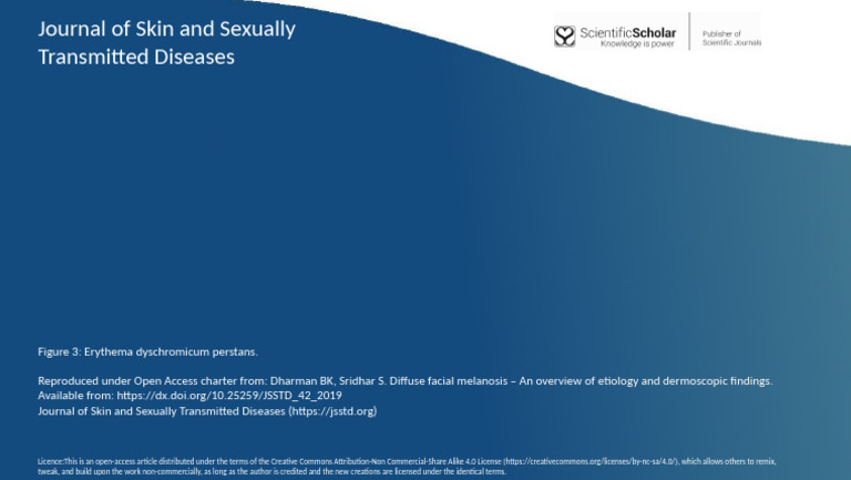 Journal of Skin | PDF