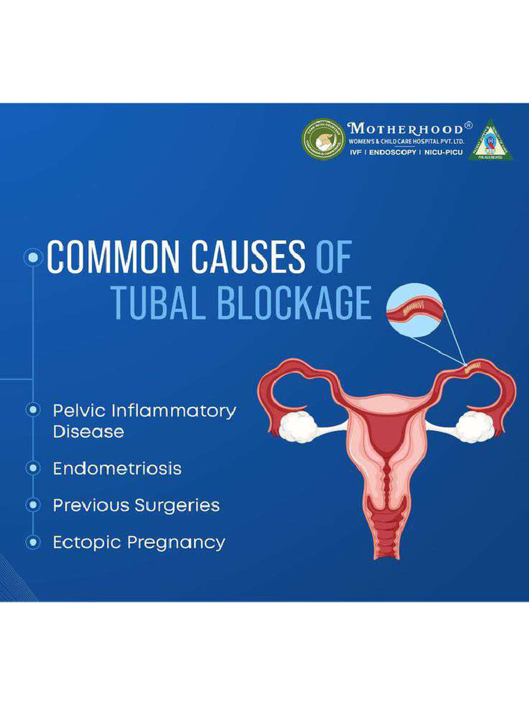 Tubal Blockage | PDF