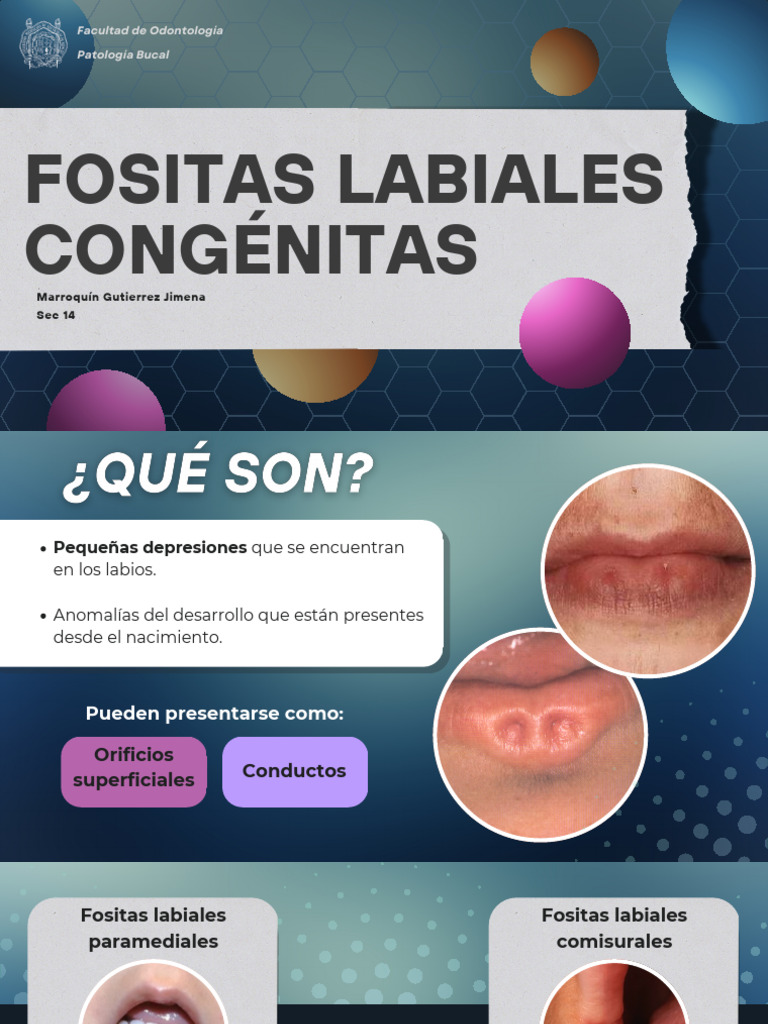 Fositas Labiales Congénitas y Paramédiales | PDF | Especialidades ...