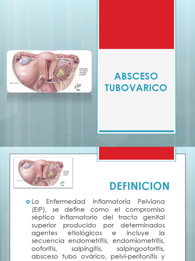 Absceso Tuboov rico Inmunolog a Ciencias De La Salud