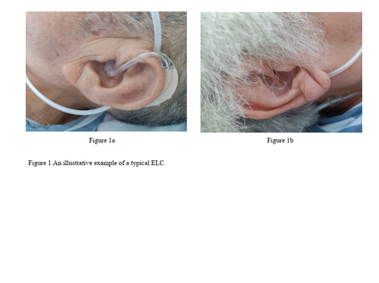 Figure 1a and Figure 1b | PDF