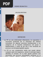 Criterios de Jones para Fiebre Reumática | PDF | Inmunología ...