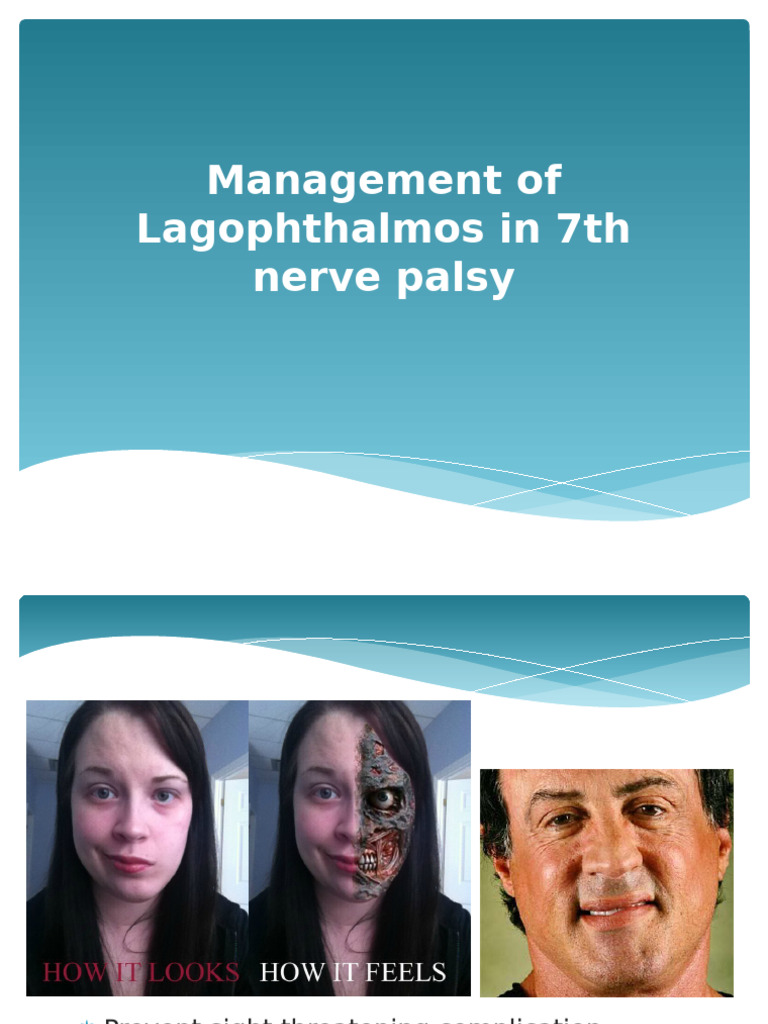 Facial Palsy With Lagophthalmos | PDF | Medical Specialties | Diseases ...