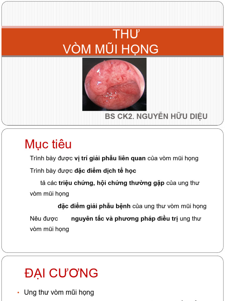 Ung Thư Vòm Mũi Họng - BMTU | PDF