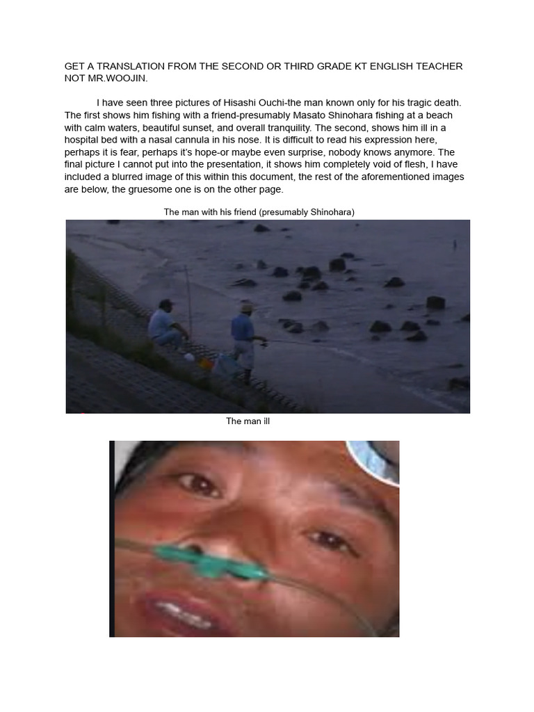 Hisashi Ouchi - A Nuclear Tragedy (First Ever Real Essay) | PDF | Acute ...