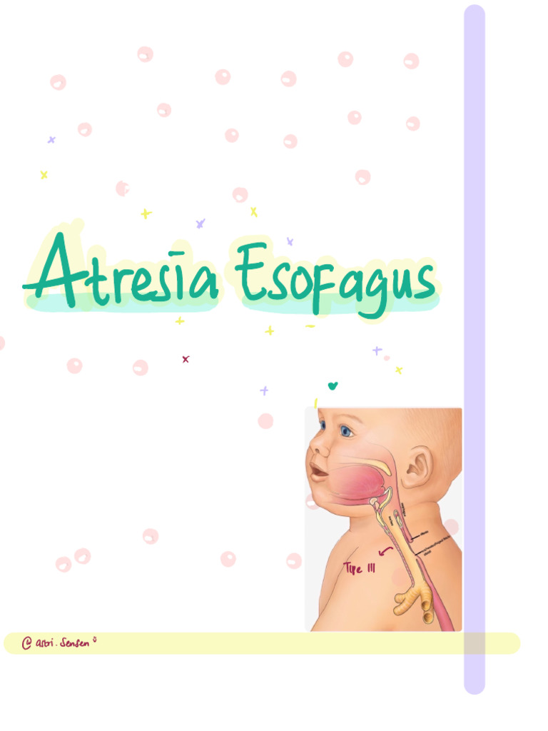 Atresia Esofagus? | PDF