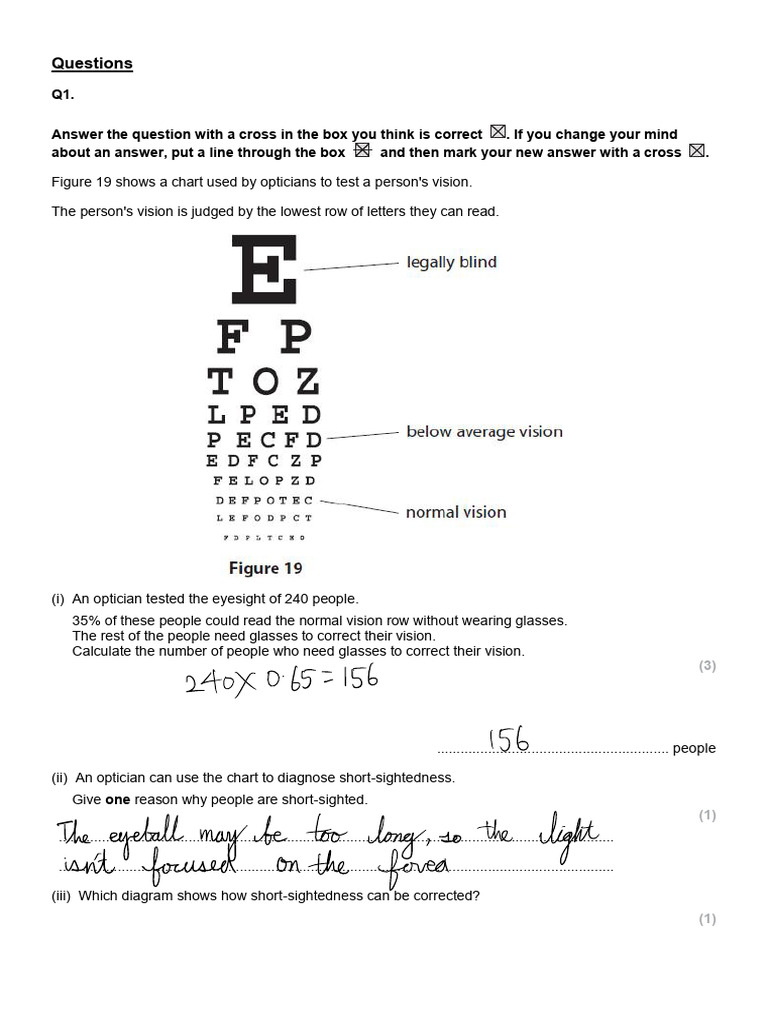 Vision Testing and Eye Conditions | PDF | Eye | Cataract