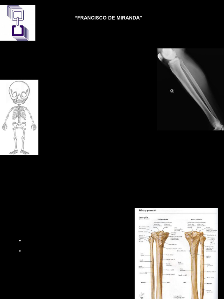 Tema XVI - Tibia y Peroné. | PDF | Sistema esquelético | Anatomía humana