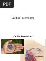 Essentio MRI Pacemaker Overview | PDF | Artificial Cardiac Pacemaker ...