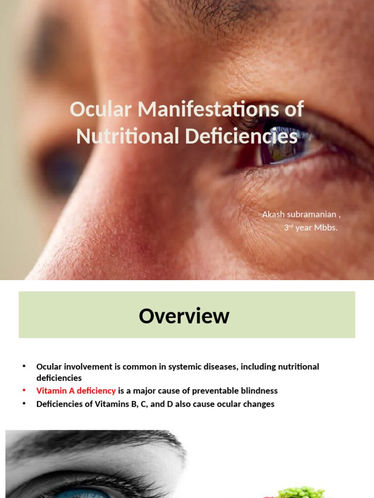 Ocular Effects of Nutritional Deficiencies | PDF | Vitamin A | Cornea