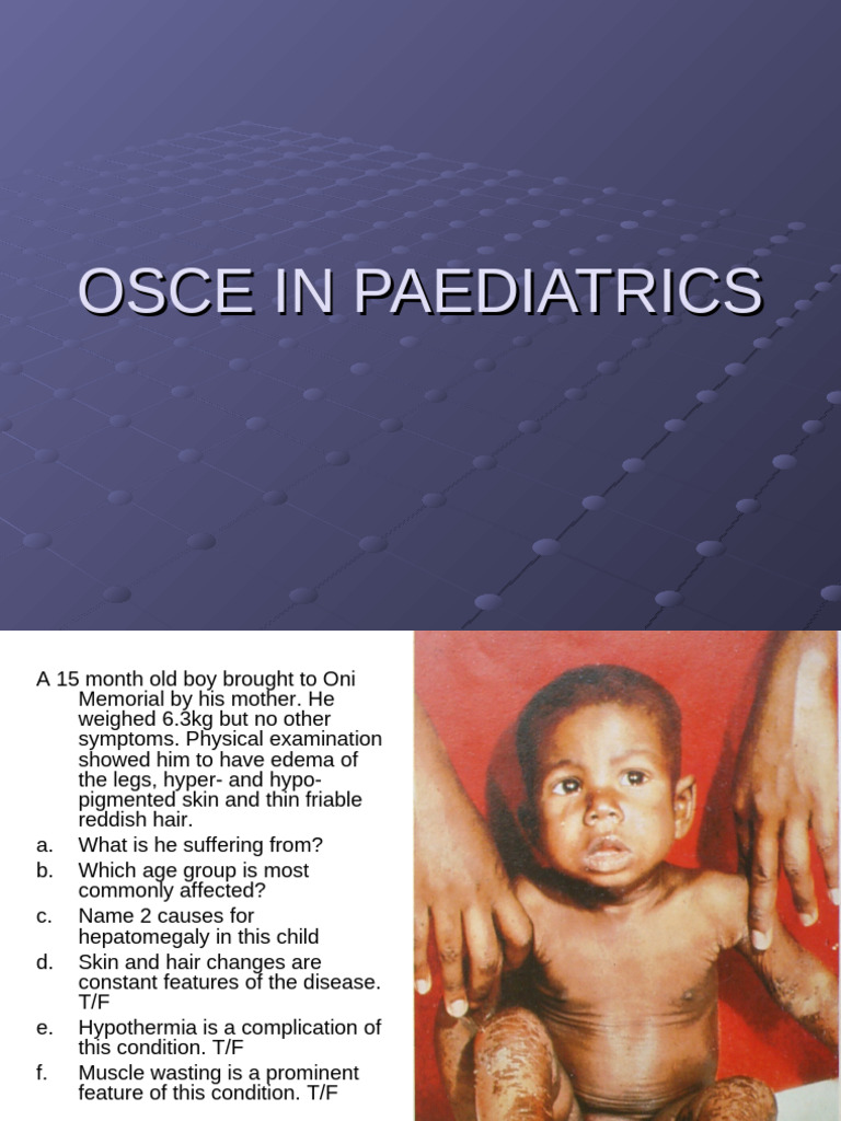 Pediatric OSCE Case Studies and Answers | PDF | Medical Specialties ...