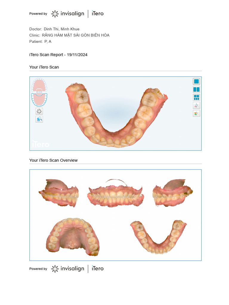 I Tero Scan Report | PDF