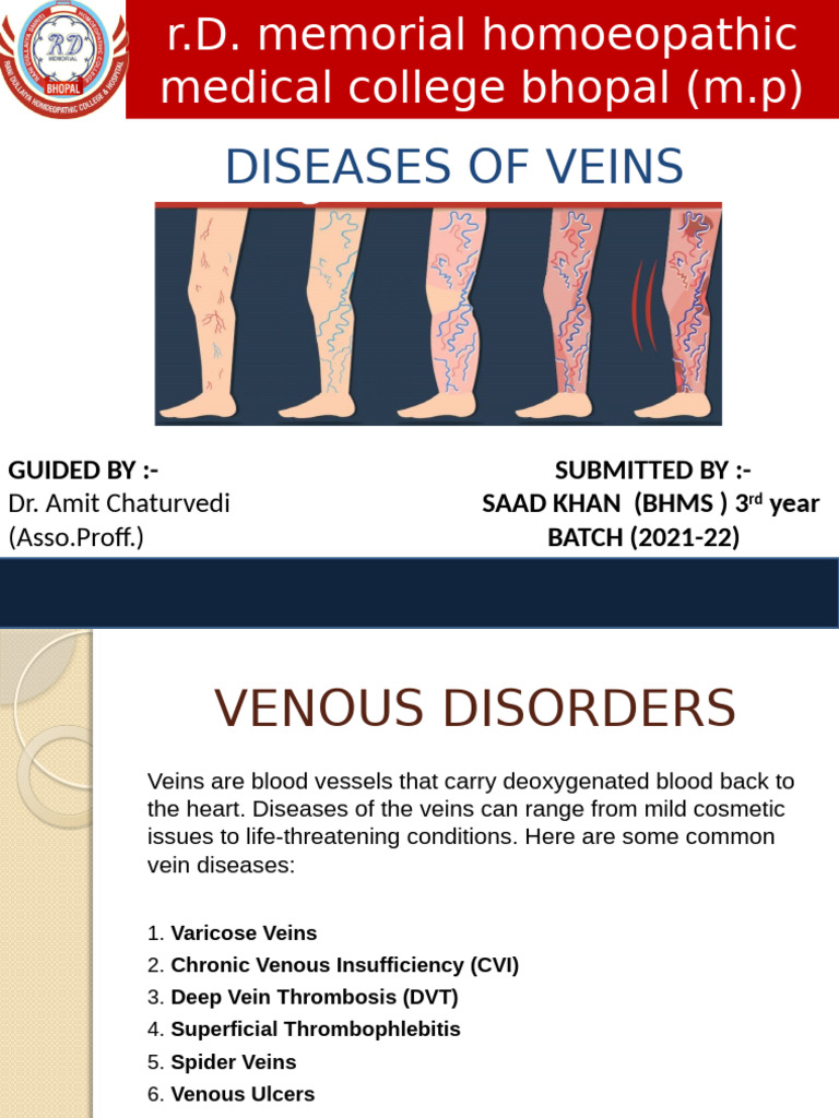 Venous Disorders: CVI and DVT Overview | PDF | Vein | Varicose Veins