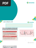 12 Lead ECG Analysis For STEMI (1) - Tagged | PDF | Electrocardiography | Visual Cortex