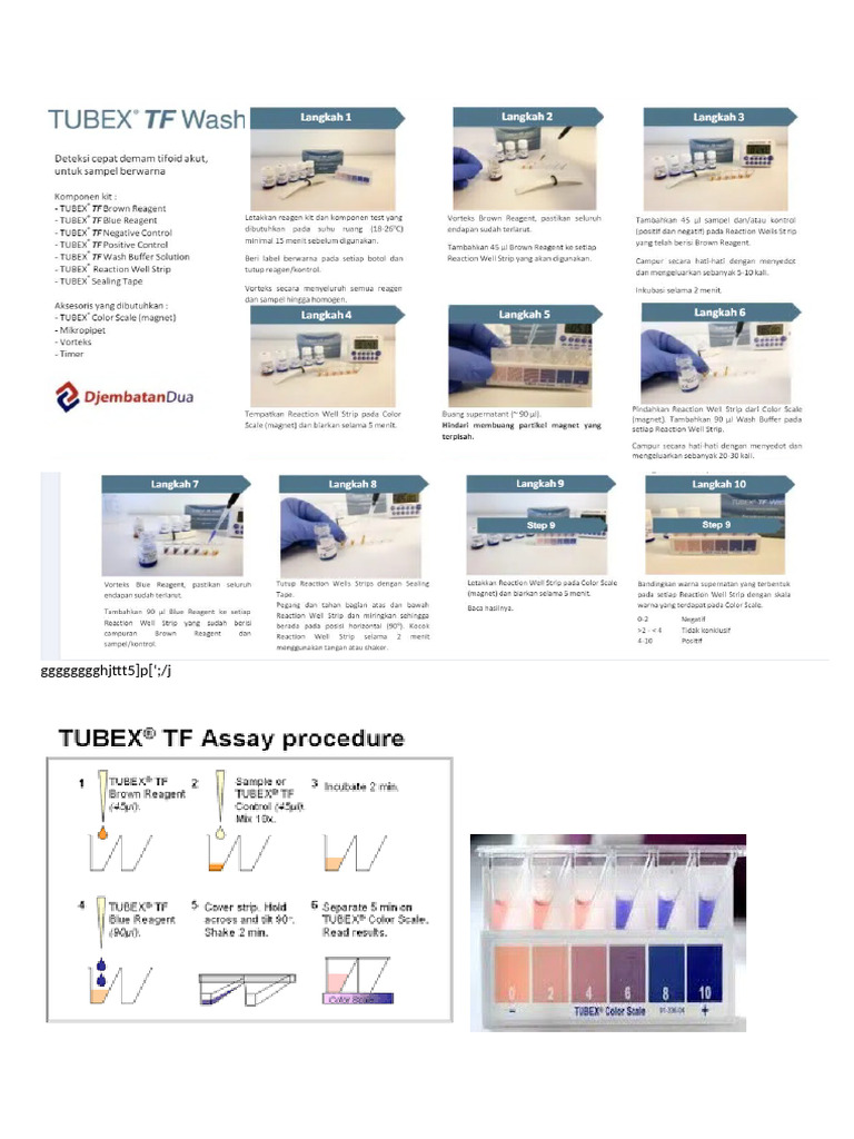 Tubex Test Salmonella | PDF