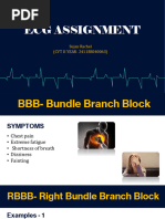 STEMI 12 Lead ECG Analysis Guide | PDF | Electrocardiography | Visual ...