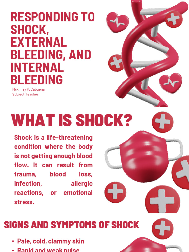 Shock and Bleeding First Aid Guide | PDF | Shock (Circulatory) | Bleeding