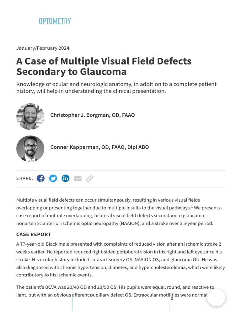 Multiple Visual Field Defects in Glaucoma | PDF | Glaucoma | Stroke