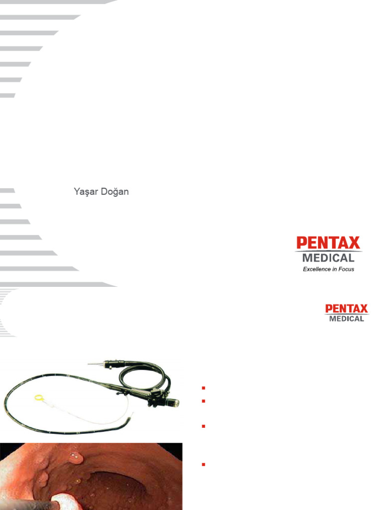 Endoscope Damage Prevention Guide | PDF