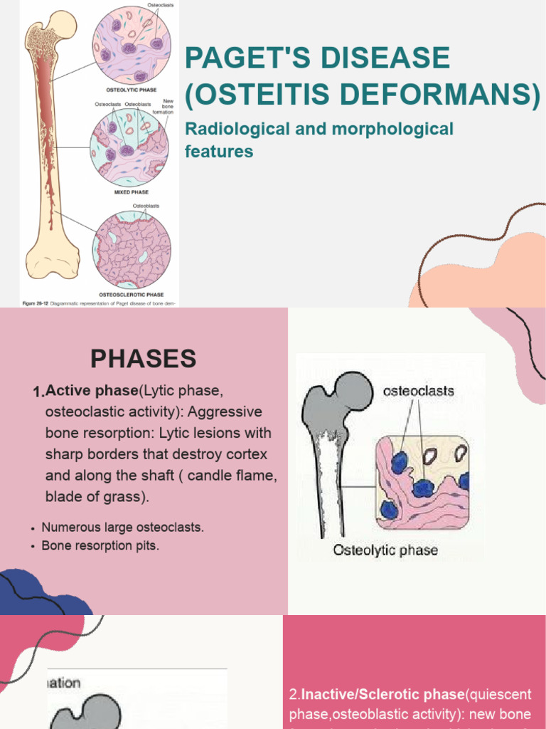 Paget's Disease 1 | PDF