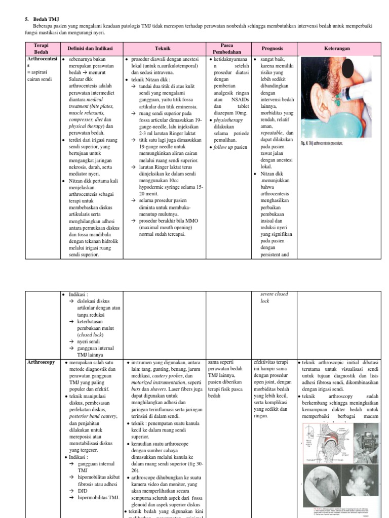 Bedah TMJ-TABEL | PDF