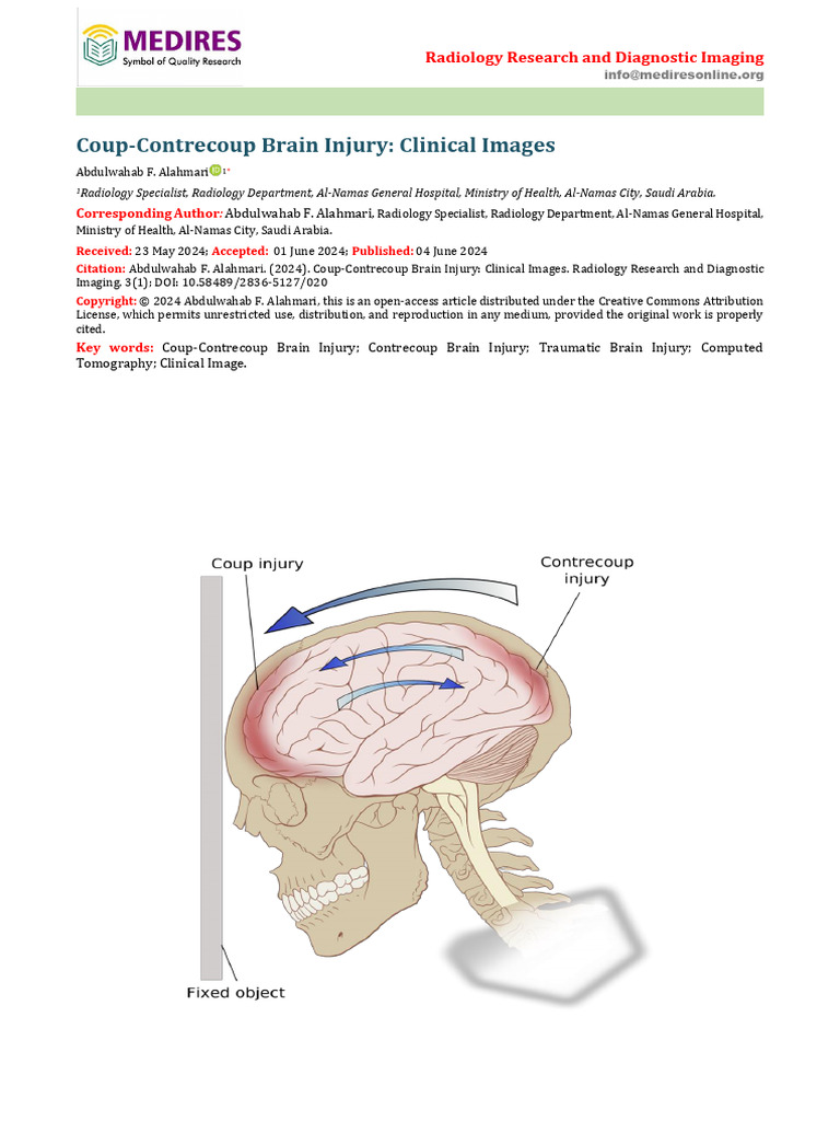 Coup-Contrecoup Brain Injury Clinical Images | PDF | Traumatic Brain ...