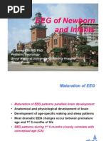 ACNS Standardized Critical Care EEG Examples 2021 | PDF ...